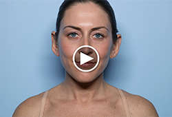 IntelliStudio | Canfield Scientific